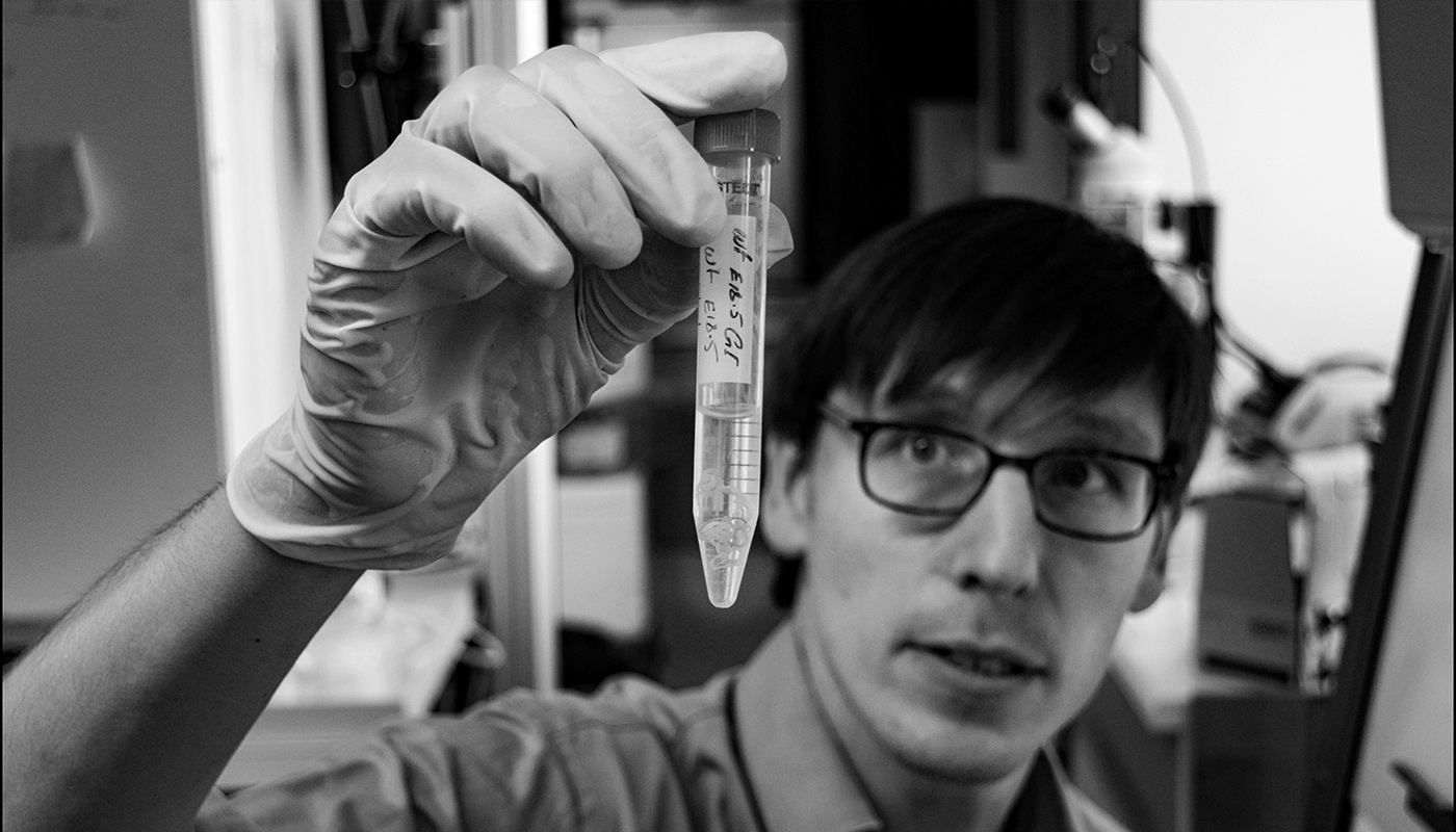 Histoires courtes : L’intestin sous toutes ses coutures - Union ...